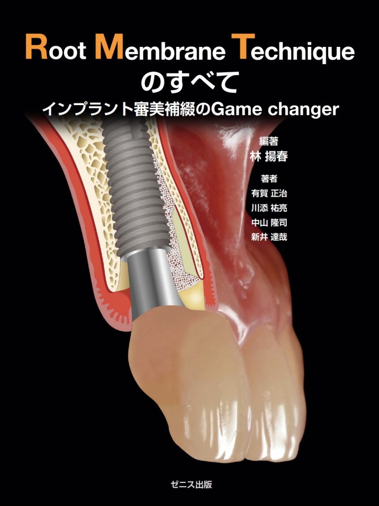 インプラント専門書「Root Membrane Technique のすべて -インプラント審美補綴のGame changer-」が発刊され ...